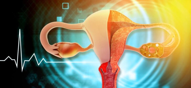 Case Summary: Luteal-Phase Stimulation (LPS) in a Patient with ...